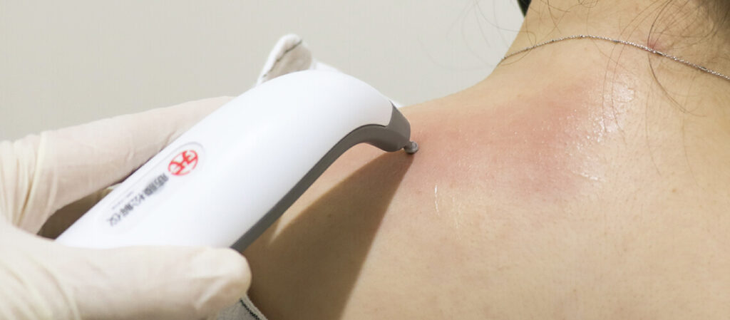 Fascia Physiotherapy - Tong Xin Tang Healthcare International